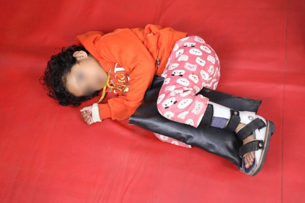 Tips for Better Sleeping in Cerebral Palsy | Trishla Foundation